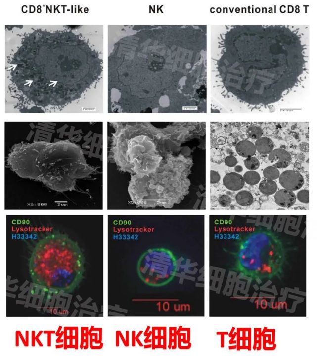 NKT、NK、T细胞，谁才是肿瘤细胞的超级杀手？_腾讯新闻