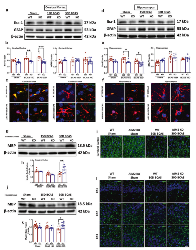 Brain：阿尔兹海默症海马CA1区的突触组织的三维分析｜导读80期_腾讯新闻