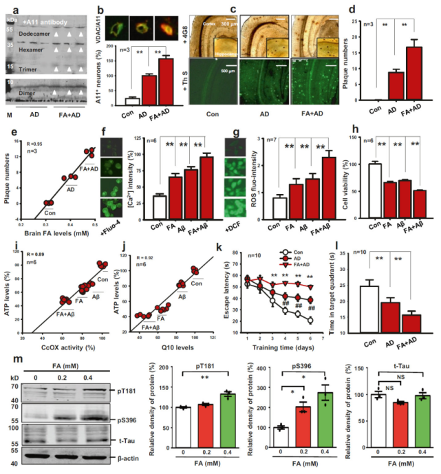 Brain：阿尔兹海默症海马CA1区的突触组织的三维分析｜导读80期_腾讯新闻
