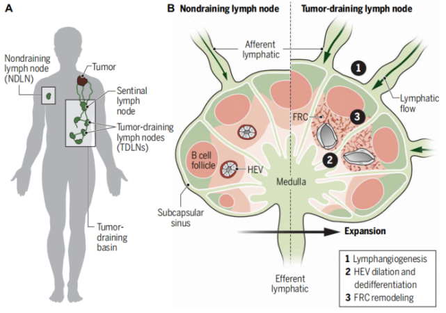 真菌影响肿瘤放疗效果？Sci Immunol 深入解读肿瘤引流淋巴结 ｜3 分钟掌握肿瘤动态_腾讯新闻
