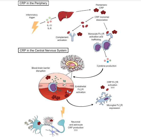 C 反应蛋白升高的 8 种临床意义解读，不只是细菌感染！_腾讯新闻