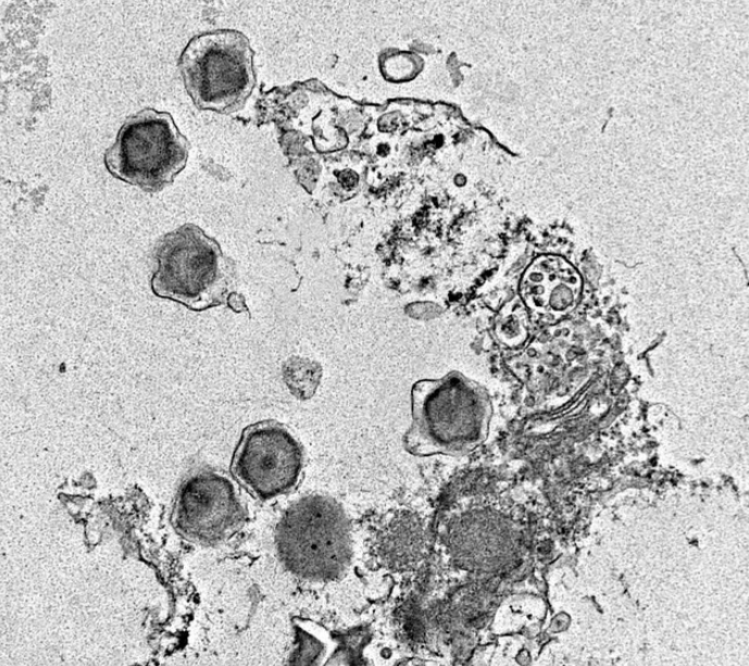 美国科学家在海洋中发现数百种神秘的巨型病毒，寒冷的海洋环境是巨型病毒的丰富储存库_腾讯新闻