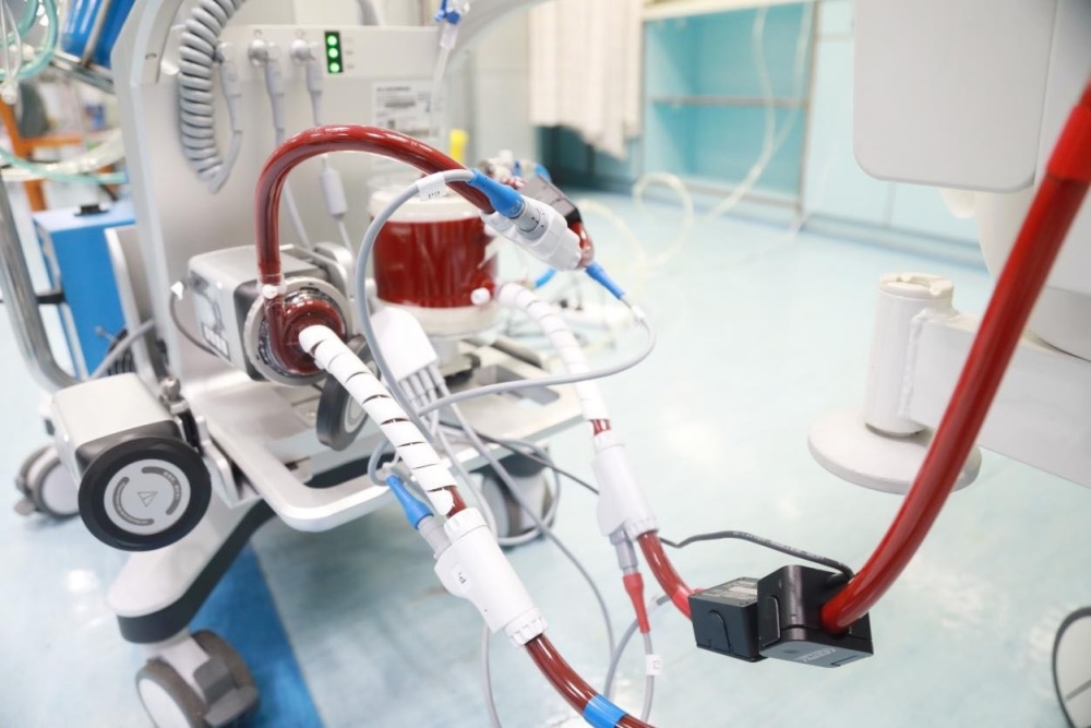 国产ECMO在华中首秀成功，亚心医院完成首例临床应用_腾讯新闻
