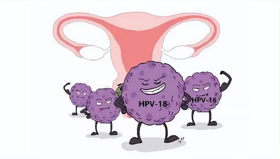 不同年龄段女性,应该多久做一次HPV筛查?感染HPV，离宫颈癌还远吗_腾讯新闻