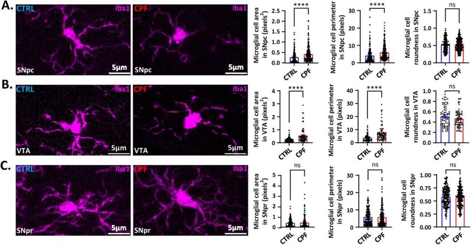 农药暴露与帕金森病关联重大突破：这种常见杀虫剂危险性明确_腾讯新闻