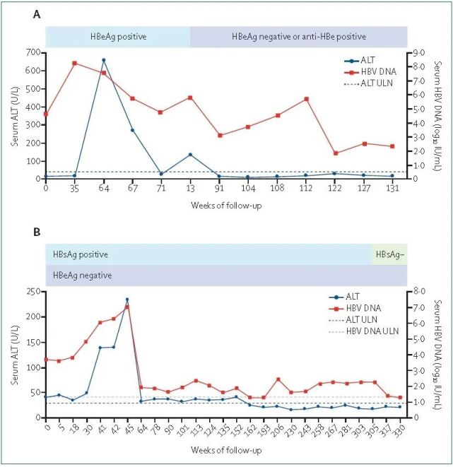 柳叶刀子刊：慢乙肝患者血清ALT骤升的意义_腾讯新闻