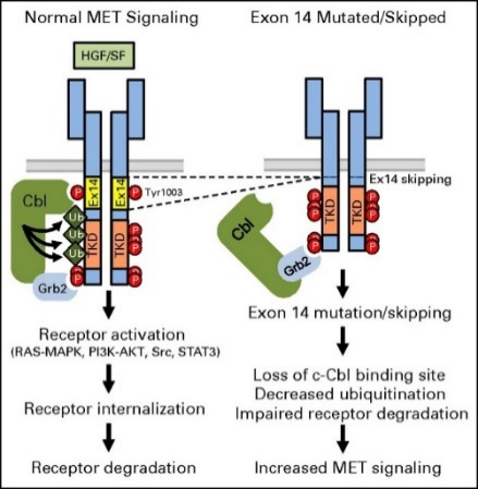 肺癌精准治疗的新靶标——MET 14 号外显子跳跃突变的检测_腾讯新闻