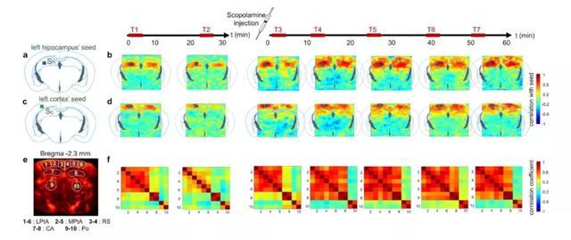 fUS脑功能成像：比fMRI更高的空间分辨率和信噪比_腾讯新闻