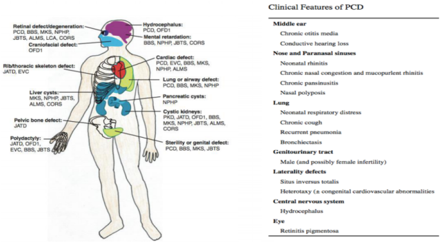 “支气管扩张只是诊断的开始，而不是结束”，从这5个经典病例，看如何追溯支扩病因并针对性治疗_腾讯新闻
