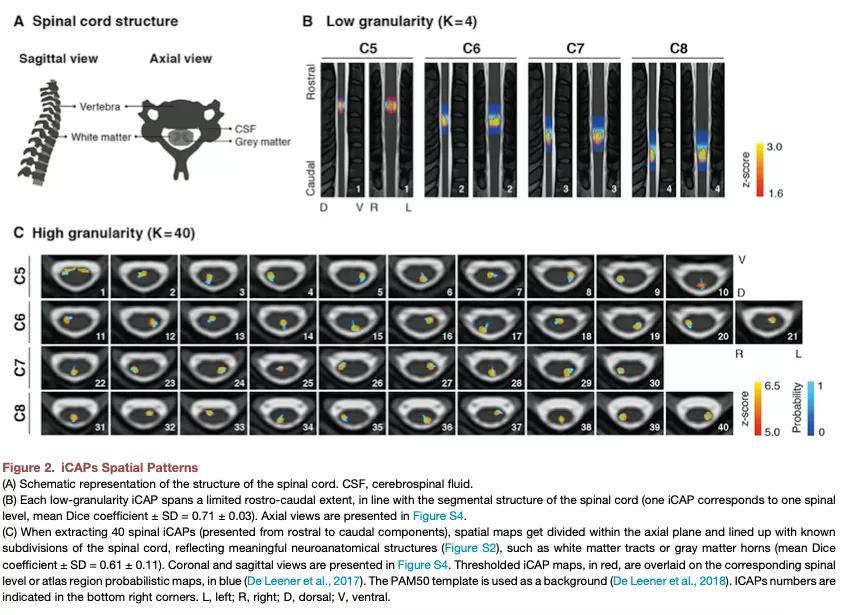 Neuron：基于静息态fMRI的动态功能连接揭示脊髓的精细内部架构_腾讯新闻
