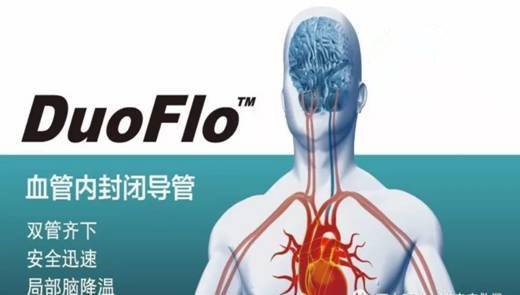 男子心脏骤停一小时 山东首用Duoflo复苏其大脑_腾讯新闻