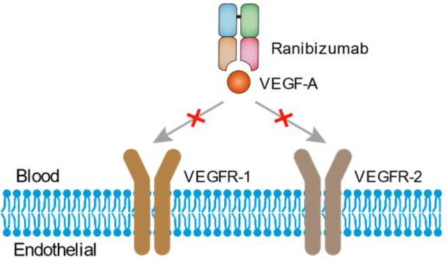 罗氏全球首款针对眼疾的双特异性抗体Faricimab III期临床效果显著！疗效更持久_腾讯新闻