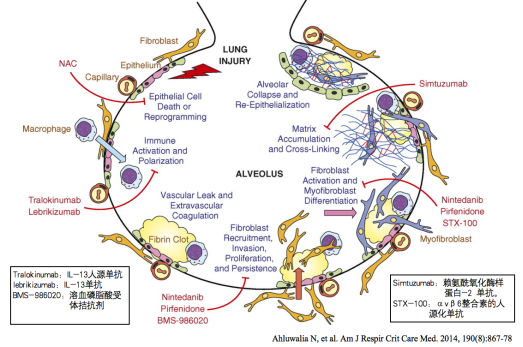 徐作军教授：已经上市和即将上市的特发性肺纤维化（IPF）治疗药物的研究进展丨CACP 2021_腾讯新闻