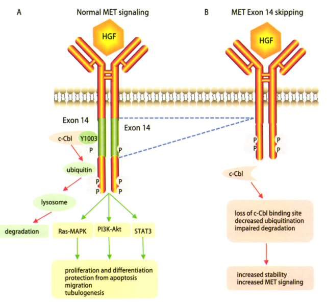 MET的前世今生：从最早发现MET靶点到治疗进展_腾讯新闻