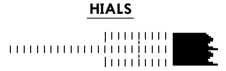 Jeppesen航图上II类进近灯是ALSF-II还是HIALS-II？_腾讯新闻