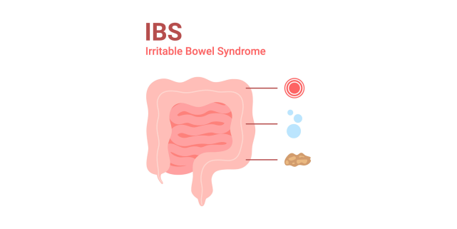 9文一览IBS研究前沿：聚焦疾病机理和干预治疗_腾讯新闻