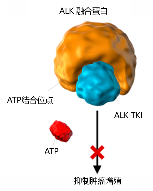 深入剖析｜为什么三代 ALK TKI 的抗肿瘤优势更强？_腾讯新闻