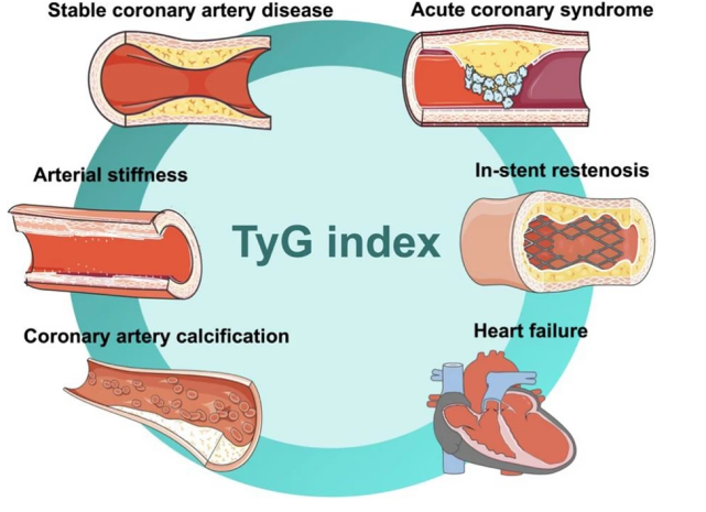 TyG指数作为心血管疾病标志物的昨天、今天和明天_腾讯新闻