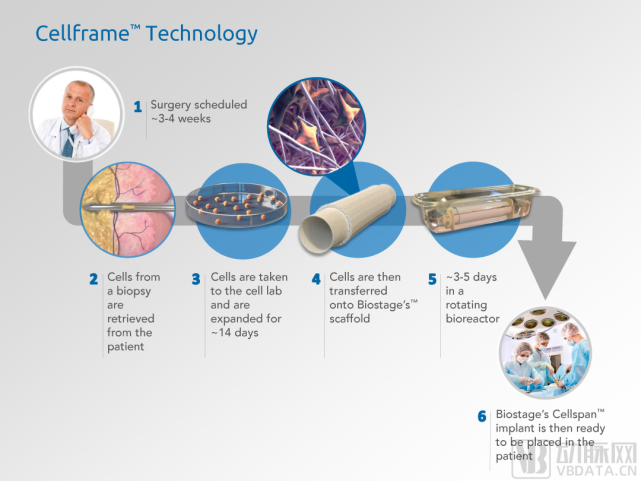 Biostage自体干细胞再生器官进入临床阶段，累计获近8000万美元融资_腾讯新闻