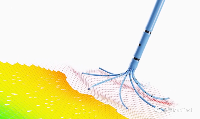 快速心脏建模！强生推出升级版标测诊断导管_腾讯新闻