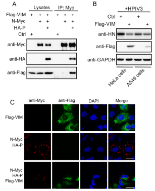 陈明周教授课题组在宿主蛋白调节HPIV3复制的机制研究方面取得新进展_腾讯新闻