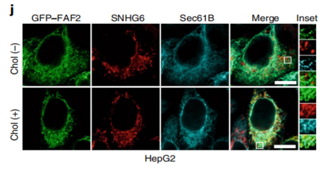 《自然·代谢》：浙大团队揭开胆固醇诱发肝癌之迷！_腾讯新闻