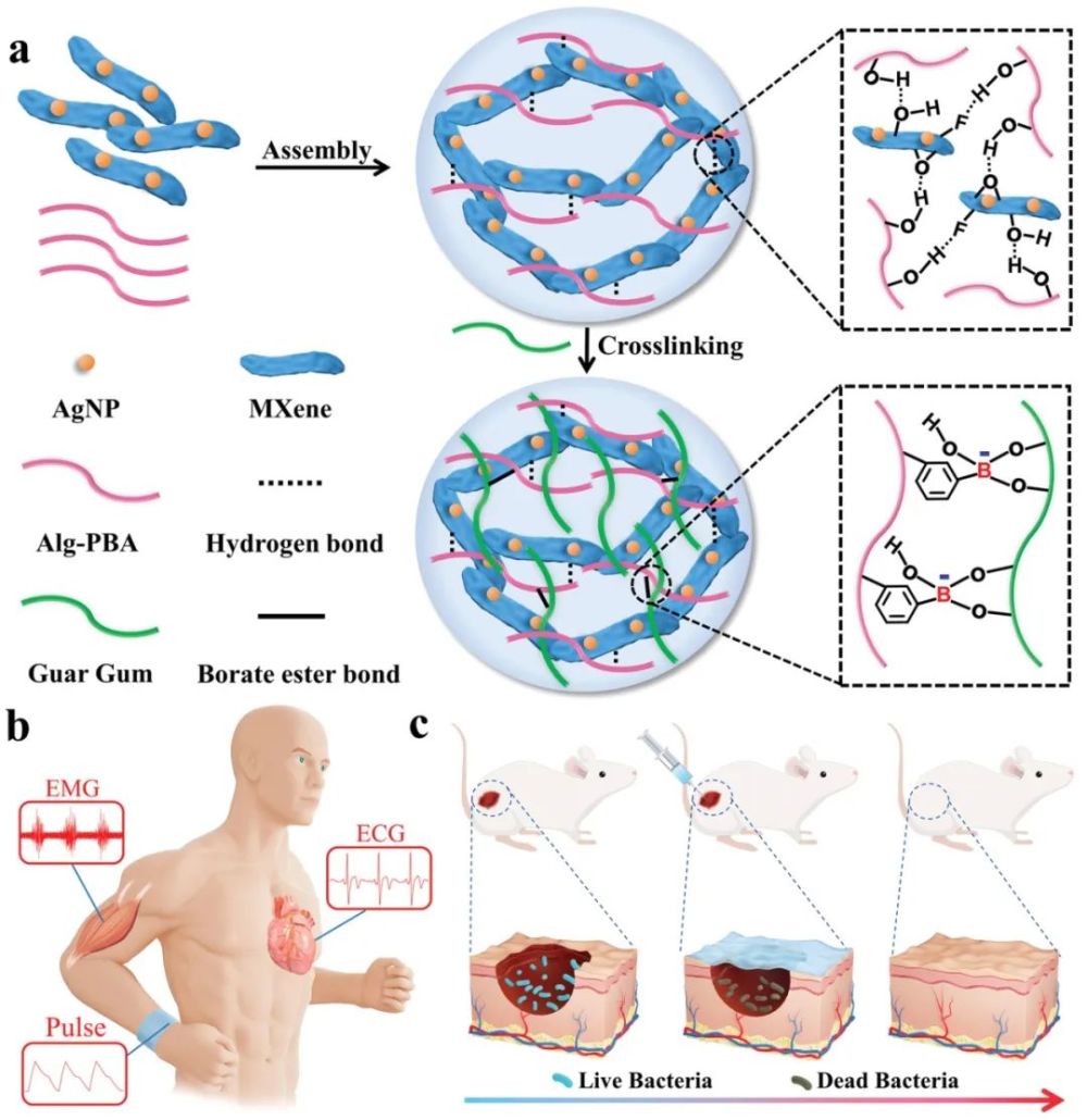 《AFM》北京化工大学万鹏博：可穿戴水凝胶柔性传感器，加速伤口愈合，实现灵敏人机交互_腾讯新闻