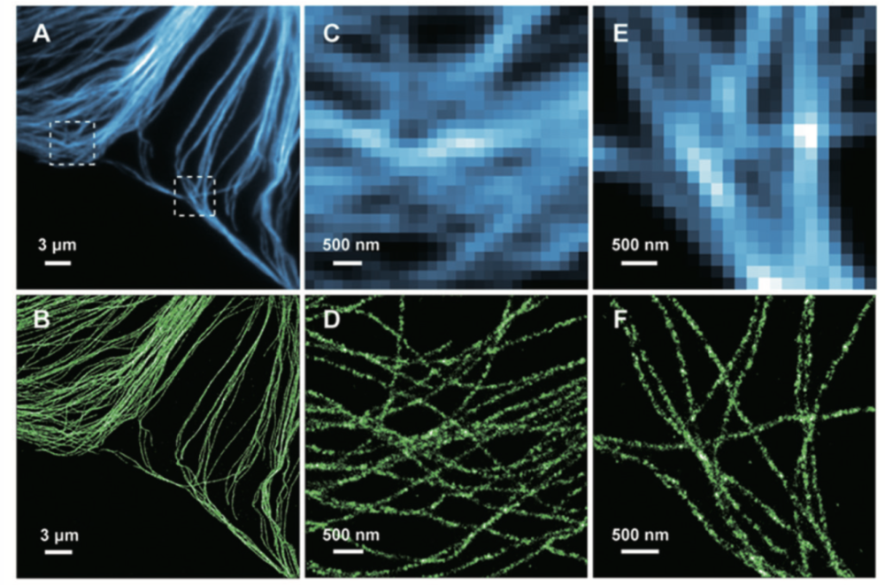 十大变革科技｜打开微观生物世界的大门：超分辨显微成像技术_腾讯新闻