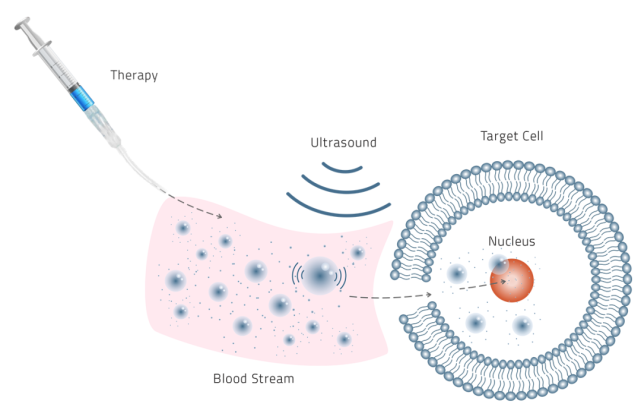 改变基因治疗范式，SonoThera融资超6000万美元，开发非病毒递送平台_腾讯新闻