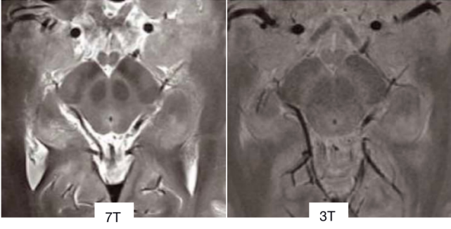 西门子医疗携手ASG！10.5T磁共振将落地中国_腾讯新闻