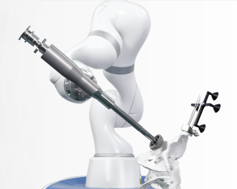 中国首家且唯一，这一手术机器人应用获批_腾讯新闻