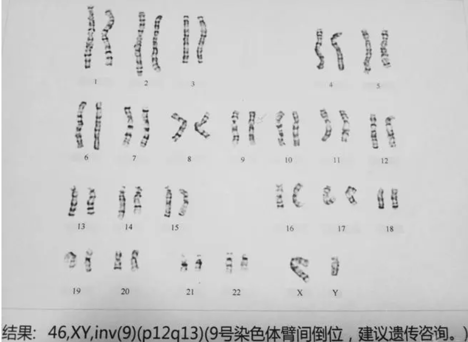 染色体报告怎么看？_腾讯新闻
