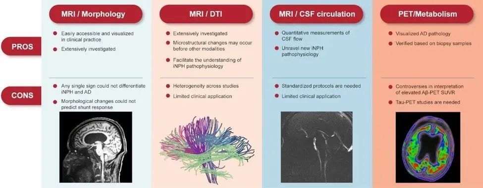 鉴别诊断特发性正常压力脑积水与阿尔茨海默病的神经影像标志物_腾讯新闻