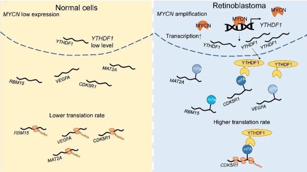 MYCN-YTHDF1轴以m6A依赖的方式促进视网膜母细胞瘤进展_腾讯新闻