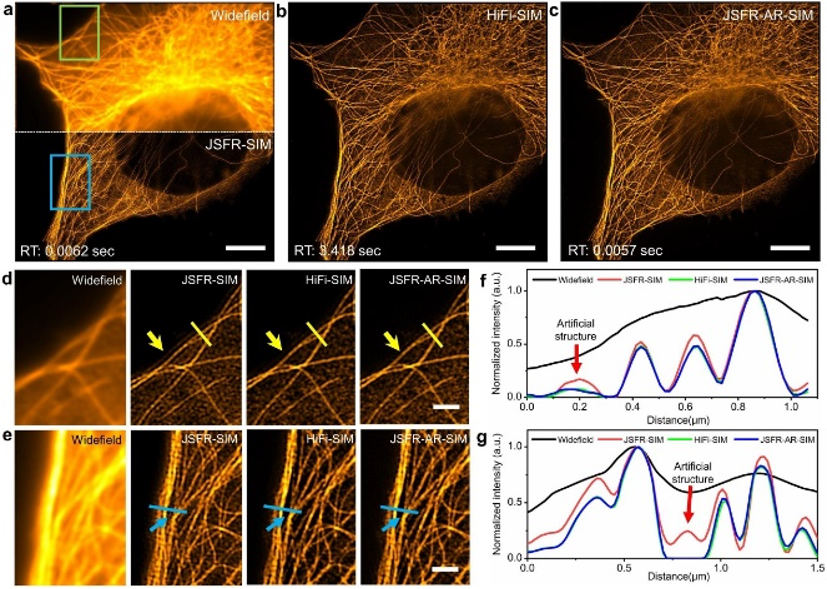 The Innovation｜超分辨结构光照明显微技术的高速无伪影图像重构_腾讯新闻