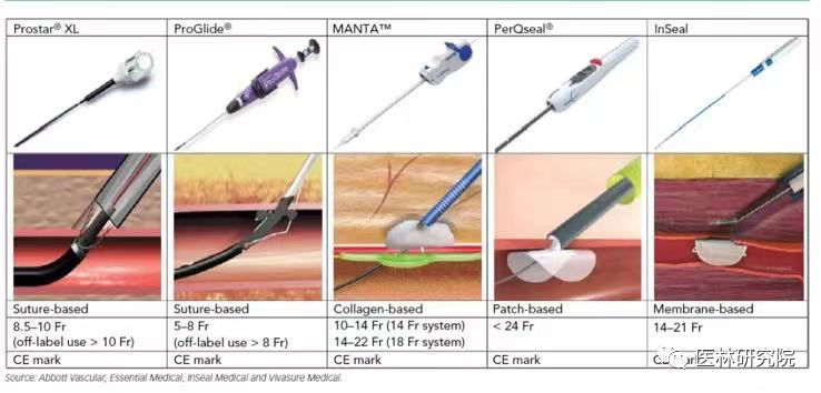 Vivasure Medical-大血管闭合，宣布首次参加关键的PATCH研究_腾讯新闻
