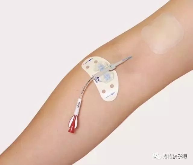 太实用了！超全的 PICC 常见问题及处理方法，值得珍藏_腾讯新闻