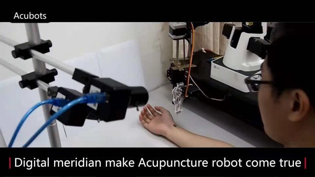 神奇！南京大学生首创针灸机器人 能自动定穴走针_大苏网_腾讯网