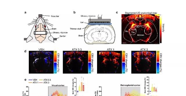 fUS脑功能成像：比fMRI更高的空间分辨率和信噪比_腾讯新闻