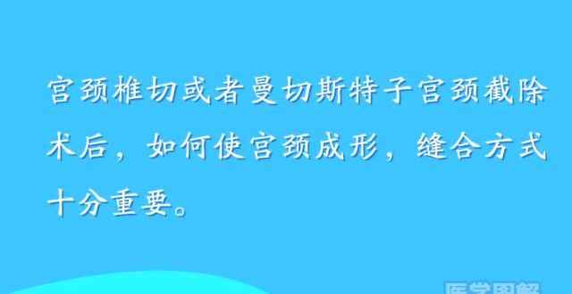 Sturmdorf缝合法丨医学图解_腾讯新闻