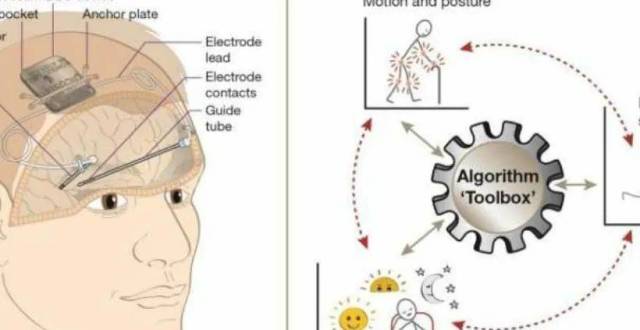 牛津大学首次将“闭环”生物电子系统植入人体｜CyberDaily_腾讯新闻