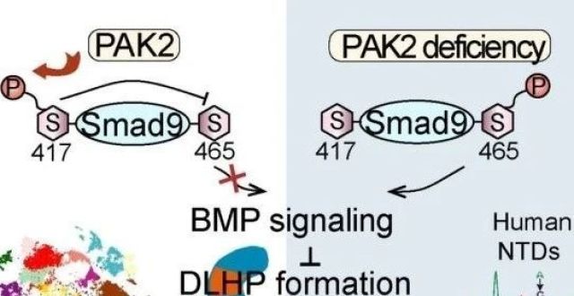 研究发现调控神经管发育新基因_腾讯新闻