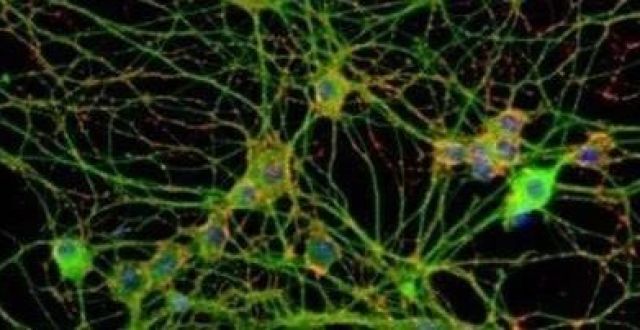 首创口服MRGPRX2拮抗剂：Escient 的EP262获FDA的IND许可，开展首次人体试验_腾讯新闻