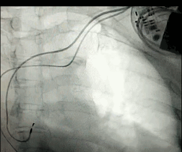 了解什么是DSA，看这篇就够了_腾讯新闻