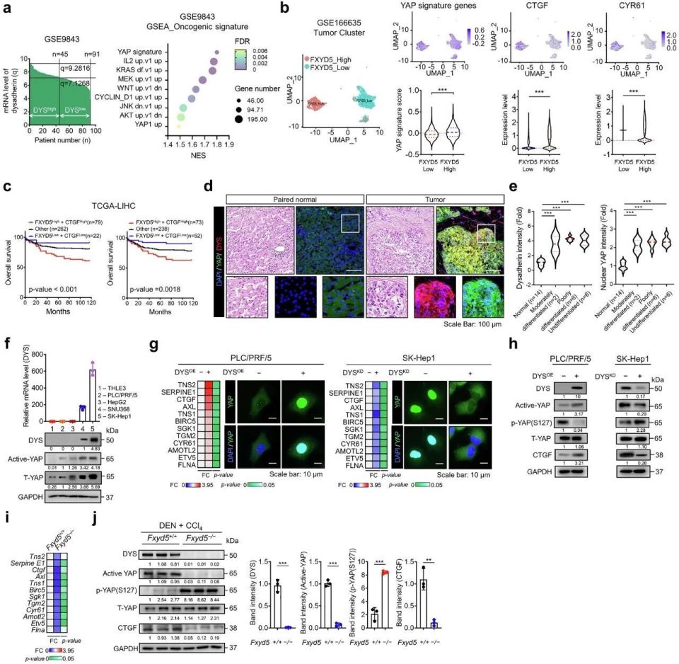 STTT | 研究团队首次系统揭示Dysadherin/YAP轴在肝癌干细胞可塑性及免疫逃逸中的关键作用_腾讯新闻