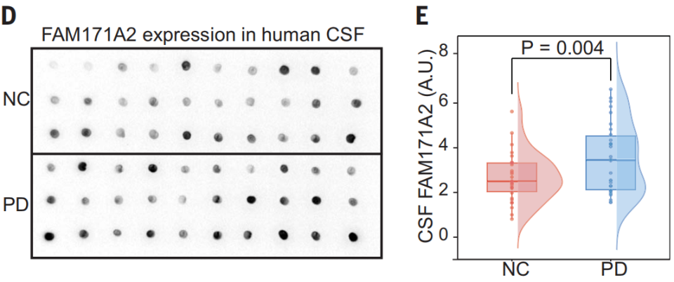 《科学》：发现帕金森病病理蛋白扩散关键！复旦华山团队找到帕金森病原始创新靶点，并找到潜在治疗药物_腾讯新闻