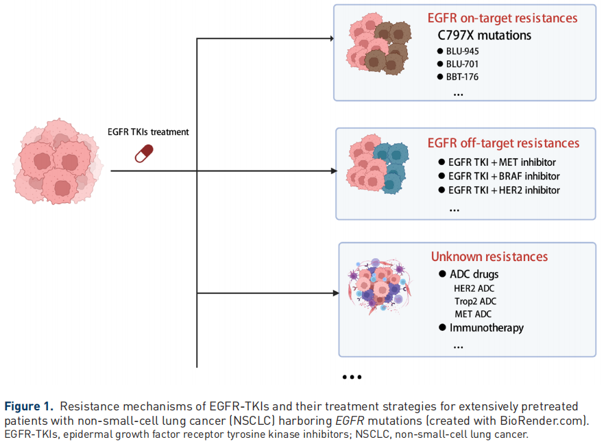 吴一龙教授团队：经EGFR-TKIs治疗的NSCLC患者的新型系统疗法，耐药了怎么办？_腾讯新闻
