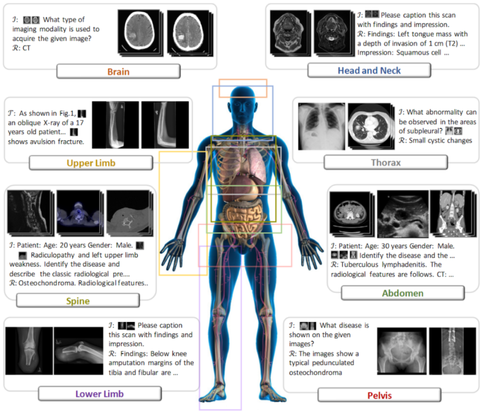 全球首个开源多模态医疗基础模型：人工打分平均超越GPT-4V、支持2D/3D放射影像_腾讯新闻