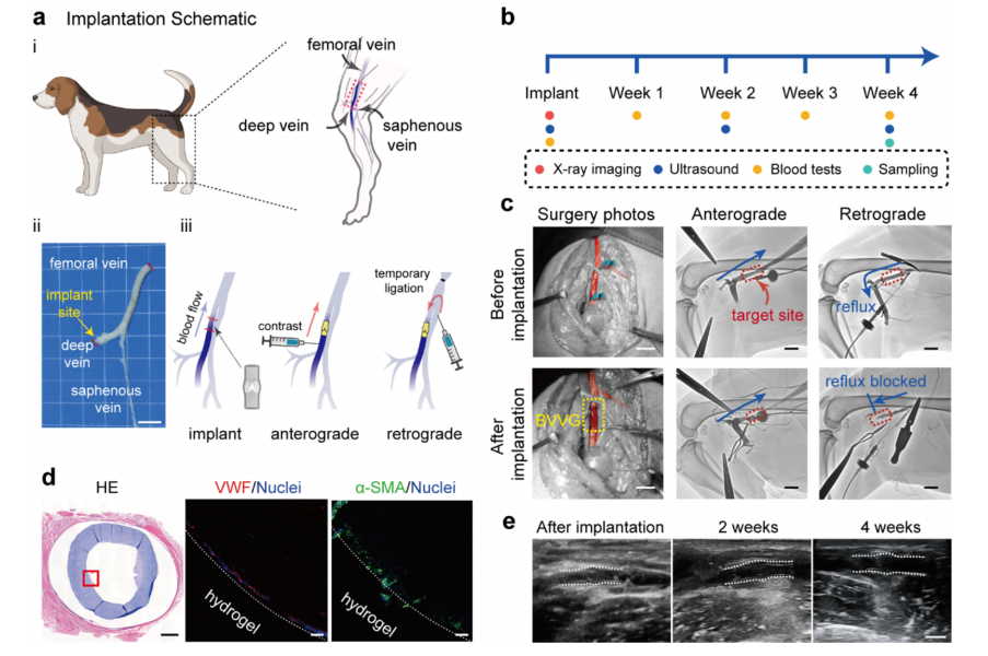 华工施雪涛、南科大刘吉ACS Nano: 3D打印强韧PVA基水凝胶构建功能性血管结构_腾讯新闻