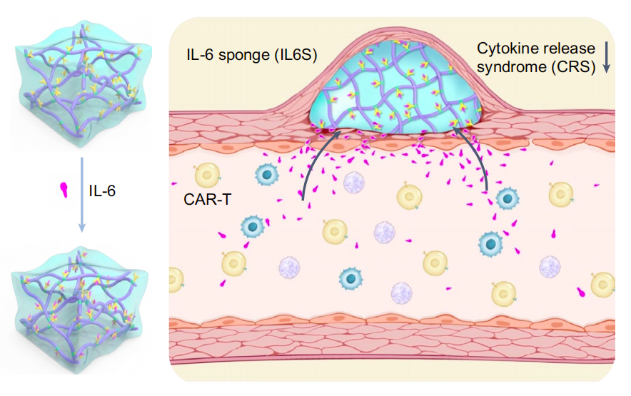 Nature子刊：梁兴杰团队开发IL-6水凝胶海绵，预防CAR-T细胞疗法副作用_腾讯新闻